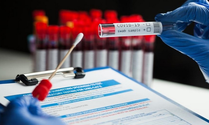 ΑΠΟ 7 ΑΠΡΙΛΙΟΥ ΣΤΑ ΦΑΡΜΑΚΕΙΑ ΤΑ SELF TESTS – ΣΕ ΠΟΙΟΥΣ ΘΑ ΔΟΘΕΙ ...