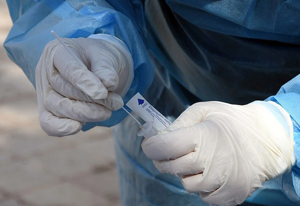 ΥΠΟΧΡΕΩΤΙΚΑ RAPID TEST ΓΙΑ ΤΟΥΣ ΕΡΓΑΖΟΜΕΝΟΥΣ ΣΤΟΝ ΙΔΙΩΤΙΚΟ ΤΟΜΕΑ - ΤΙ ...