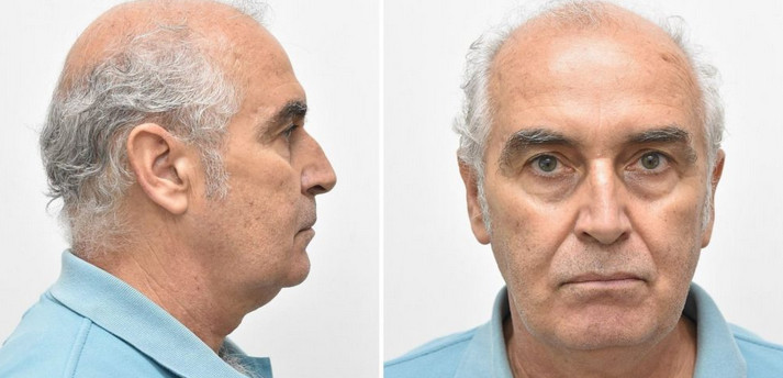 ΑΥΤΟΣ ΕΙΝΑΙ Ο ΤΗΛΕΟΠΤΙΚΟΣ ΠΑΡΑΓΩΓΟΣ ΠΟΥ ΑΣΕΛΓΟΥΣΕ ΣΕ ΑΝΗΛΙΚΕΣ ΚΑΙ ...