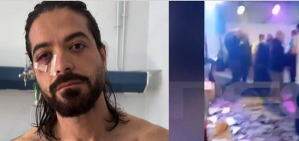 ΑΡΗΣ ΜΟΥΓΚΟΠΕΤΡΟΣ "ΤΟΥ ΕΔΩΣΑΝ ΚΡΟΤΙΔΑ ΣΤΟ ΧΕΡΙ & ΝΟΜΙΣΕ ΟΤΙ ΗΤΑΝ ...